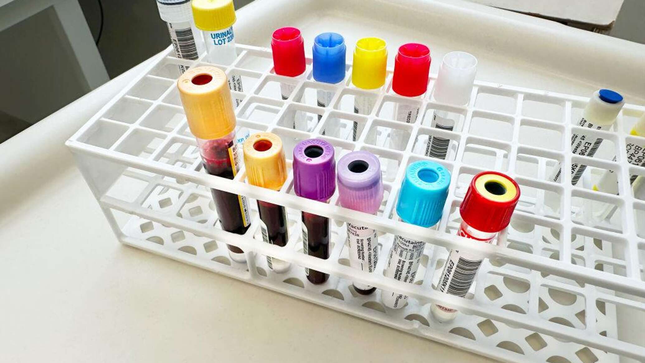 Новый заразный штамм коронавируса "стратус" распространяется в Британии ...